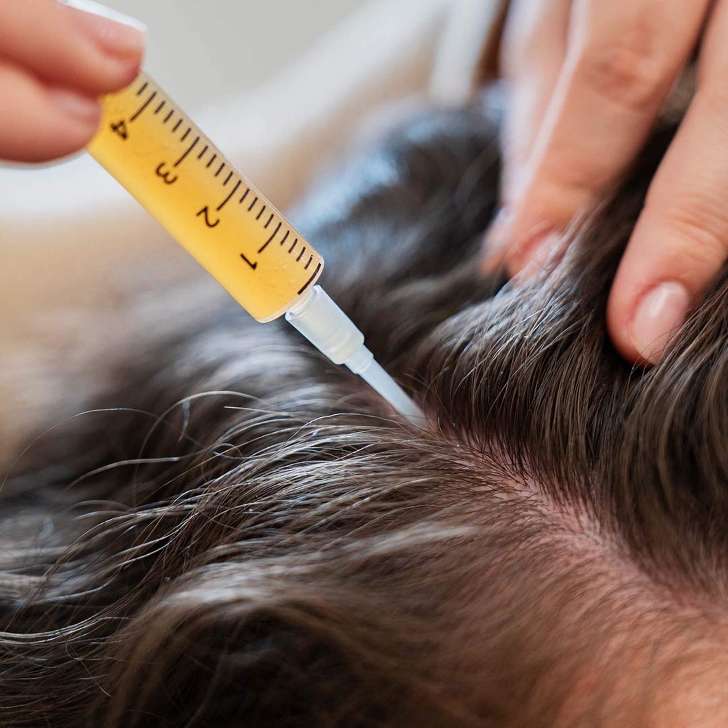 Customised Scalp Care to Maximise Hair Growth | Harklinikken AE ...